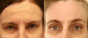 Before & After Gallery - NuBody Concepts