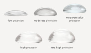 Breast Implant Types - NuBody Concepts